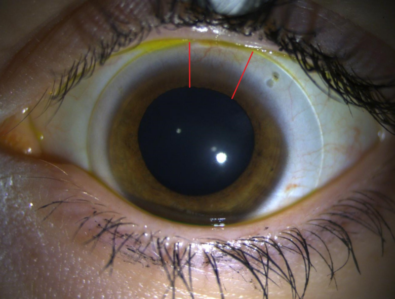 Contact & Intraocular Lens Material Manufacturer