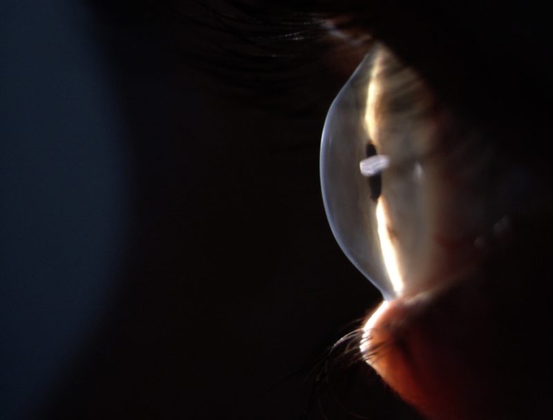 Contact & Intraocular Lens Material Manufacturer