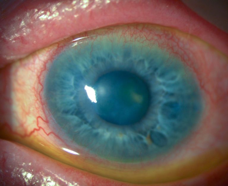 Contact & Intraocular Lens Material Manufacturer
