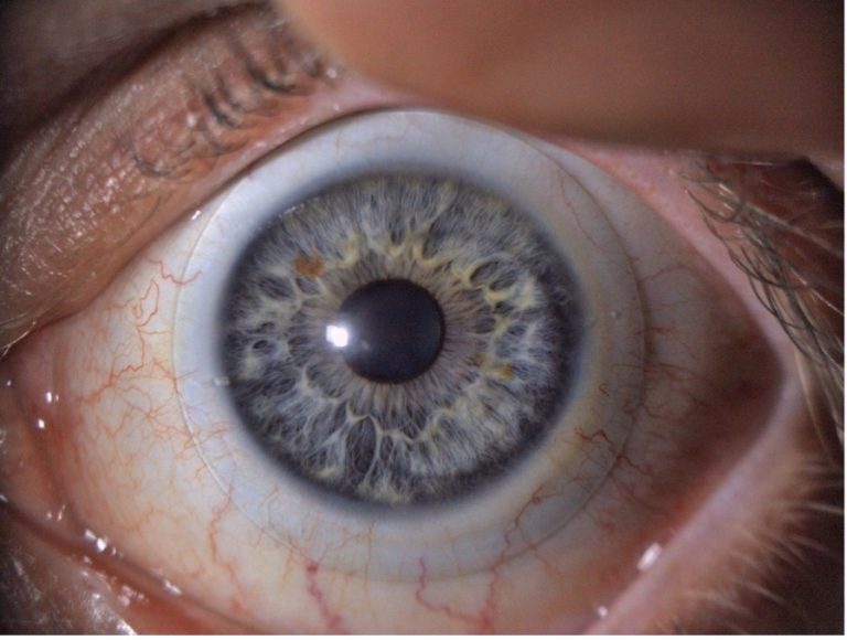Contact & Intraocular Lens Material Manufacturer